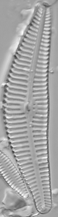 Diatom Image Archive (DIA)