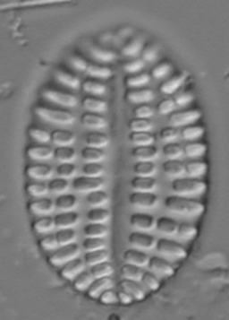 Diatom Image Archive (DIA)