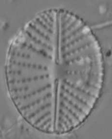 Diatom Image Archive (DIA)