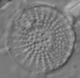 Diatom Image Archive (DIA)
