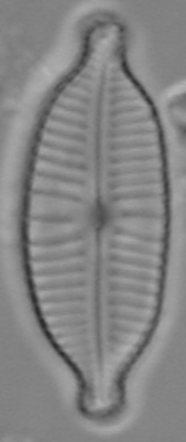 Diatom Image Archive (DIA)