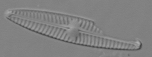 Diatom Image Archive (DIA)