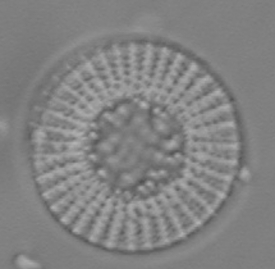 Diatom Image Archive (DIA)