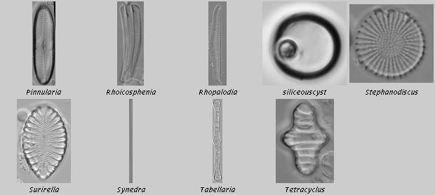 Diatom Image Archive (DIA)