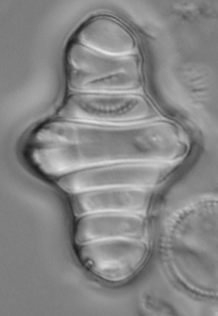 Diatom Image Archive (DIA)